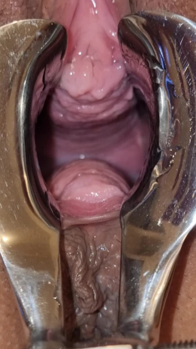 Spekulum Nasse Vagina Sex Toy Sex Toy Porn Feat Electro83 Xhamster 0939