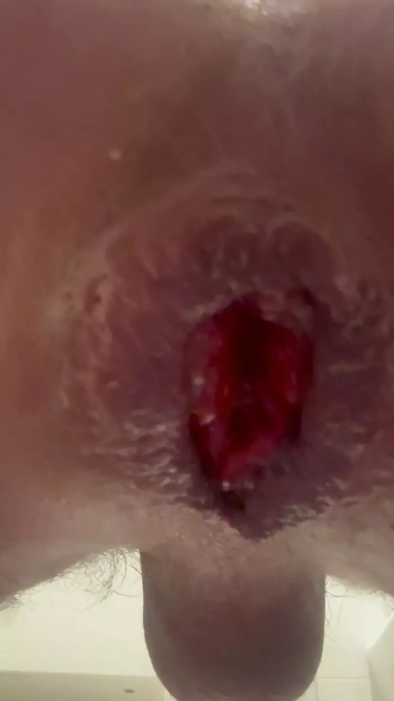 Open Anus Gay Amateur Amateur Porn Feat Hotmajkyo Xhamster
